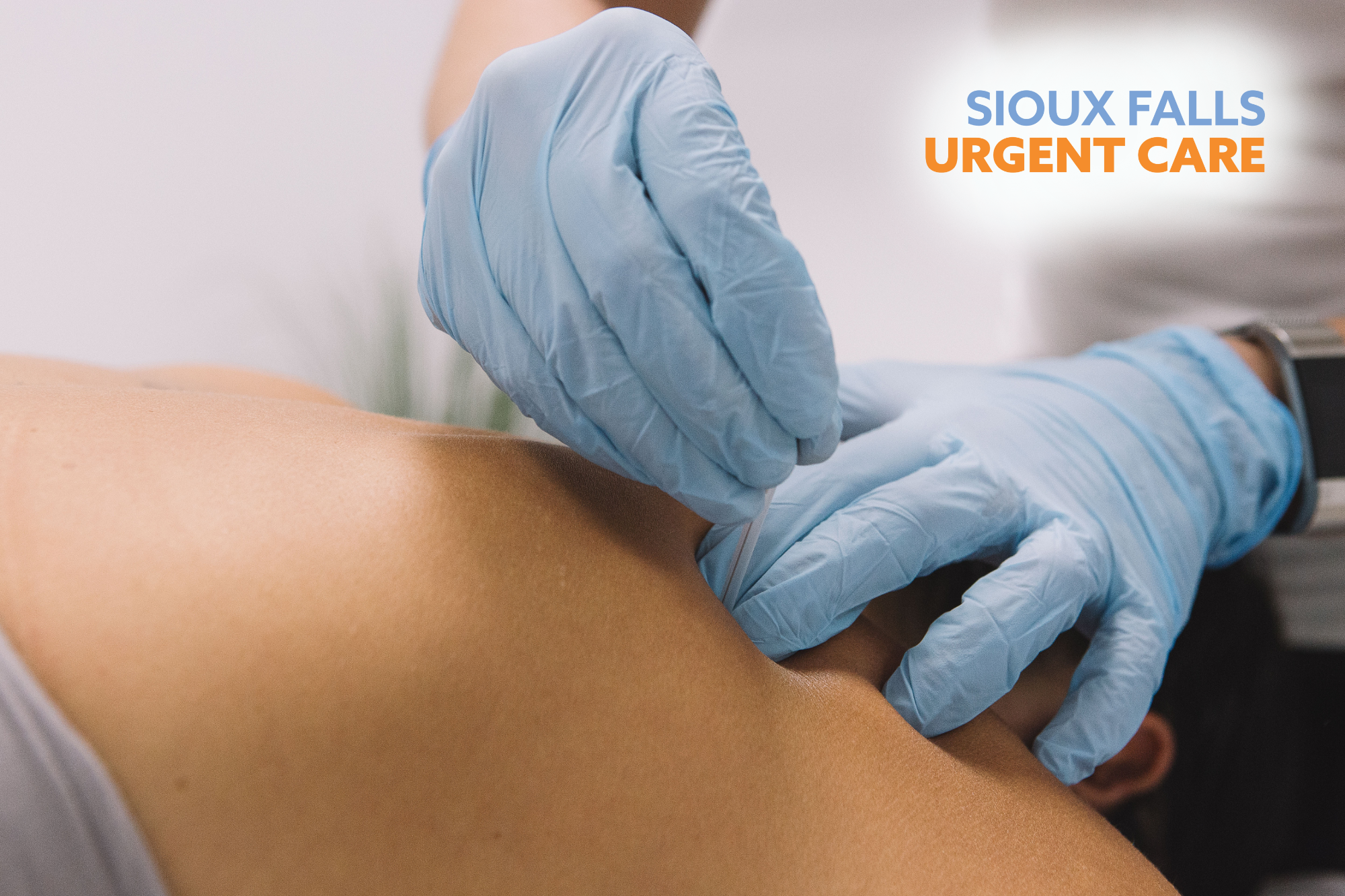 Dry Needling vs. Acupuncture